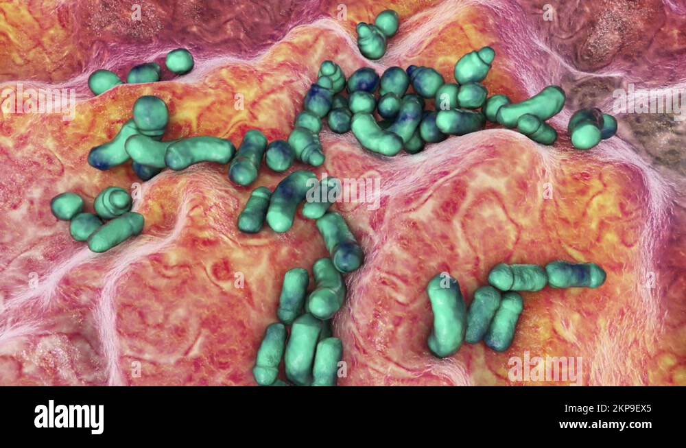 Malassezia skin fungus Stock Videos & Footage - HD and 4K Video Clips ...