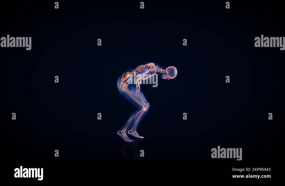 Human x-ray body and skeleton, big stomack pain loop Stock Video ...