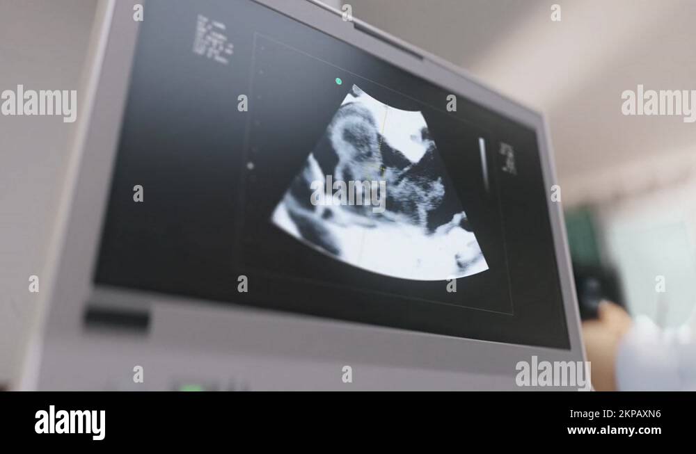 Prenatal scan Stock Videos & Footage - HD and 4K Video Clips - Alamy