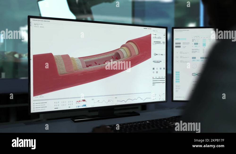 Blood circulation using Stock Videos & Footage - HD and 4K Video Clips ...