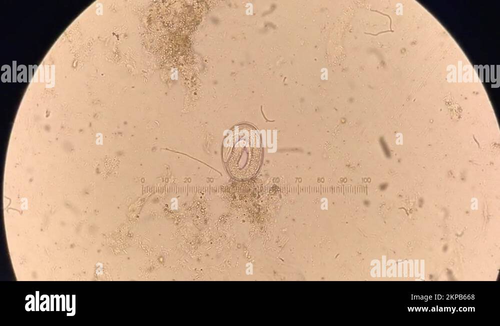 Nematode parasitic worm in microscope. larva inside ova movement Stock ...