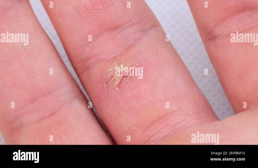 Cracked detail Stock Videos & Footage - HD and 4K Video Clips - Alamy
