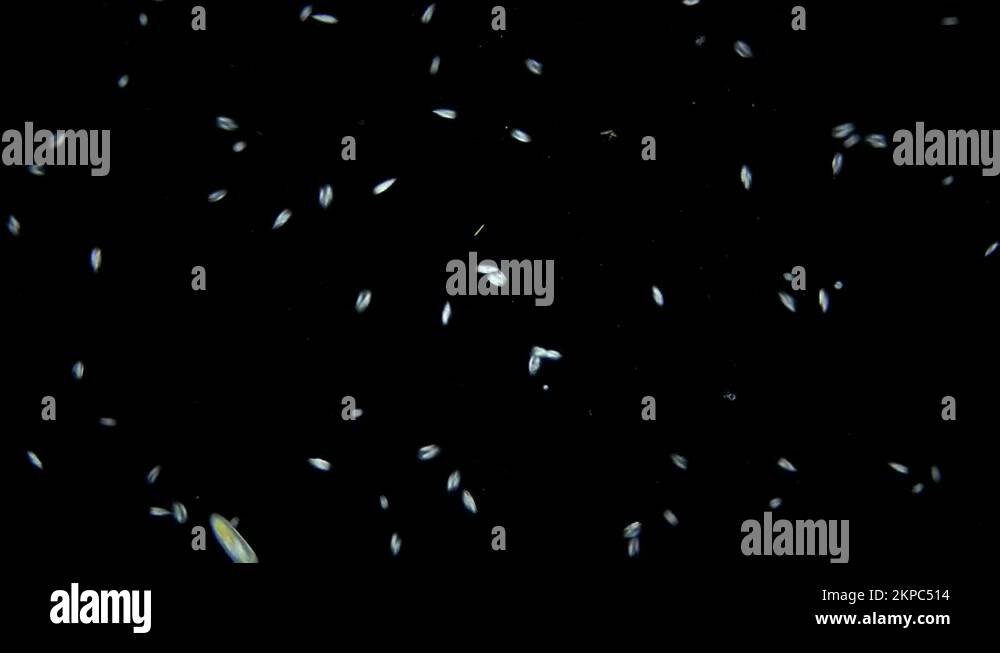 Infusorium colony Ciliophora Hypotrichia and Coleps under a microscope ...