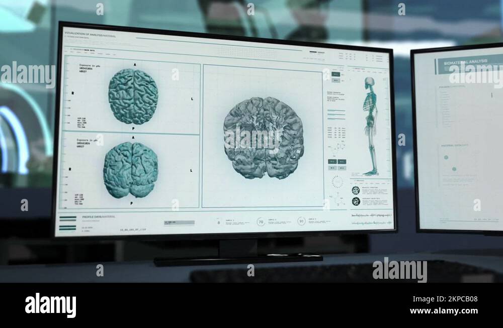 Patient head scan Stock Videos & Footage - HD and 4K Video Clips - Alamy