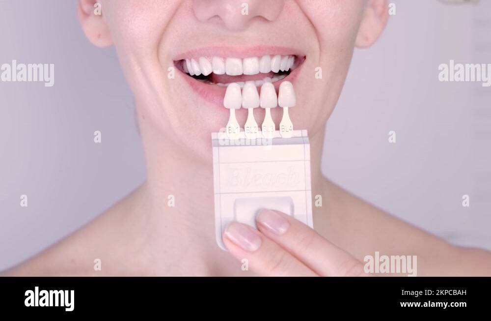 Perfect White Teeth Close Up With Shade Guide Bleach Color Female
