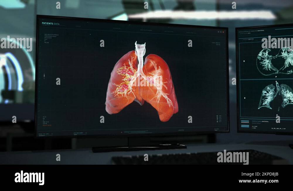Respiratory Organ Displayed In Healthcare Interface To Diagnose Lung ...