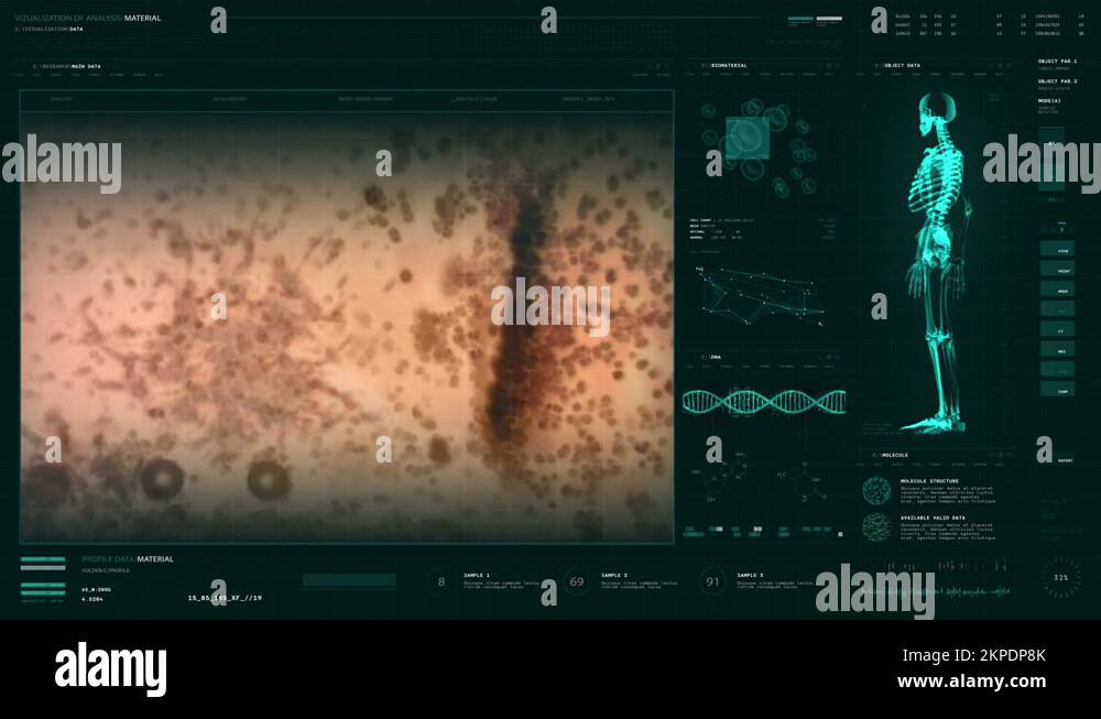 Analyzing the dangerous microbe colony in a human body for biological ...