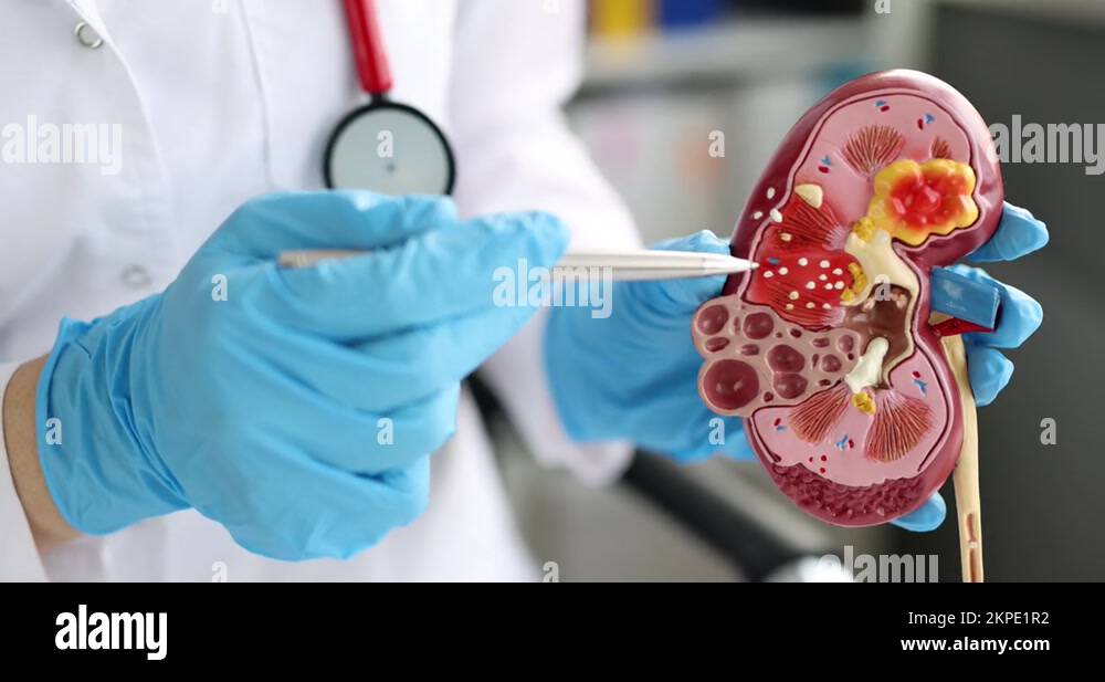Anatomical model kidney Stock Videos & Footage - HD and 4K Video Clips ...