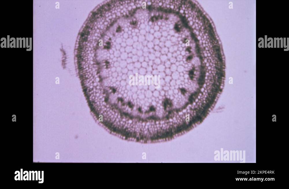 1940s: Cells, cross section of plant under light microscope. Plant ...