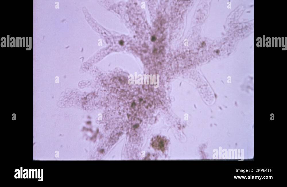 1940s: Cells under light microscope, large, dark masses. Tiny specks ...