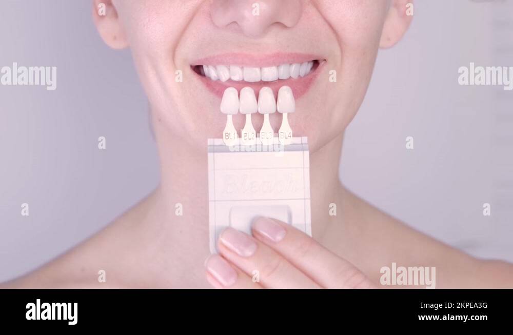 Teeth shade guide Stock Videos & Footage - HD and 4K Video Clips - Alamy