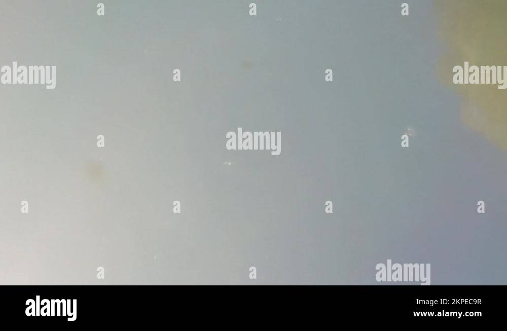 Pulmo Stock Videos & Footage - HD and 4K Video Clips - Alamy