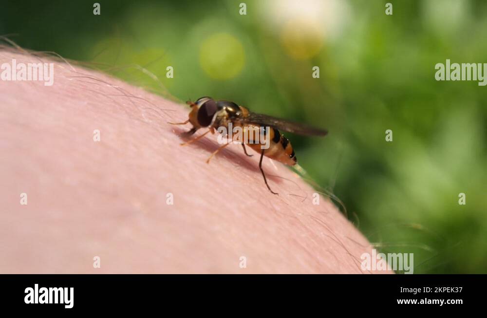Insect bite skin on black skin Stock Videos & Footage - HD and 4K Video ...