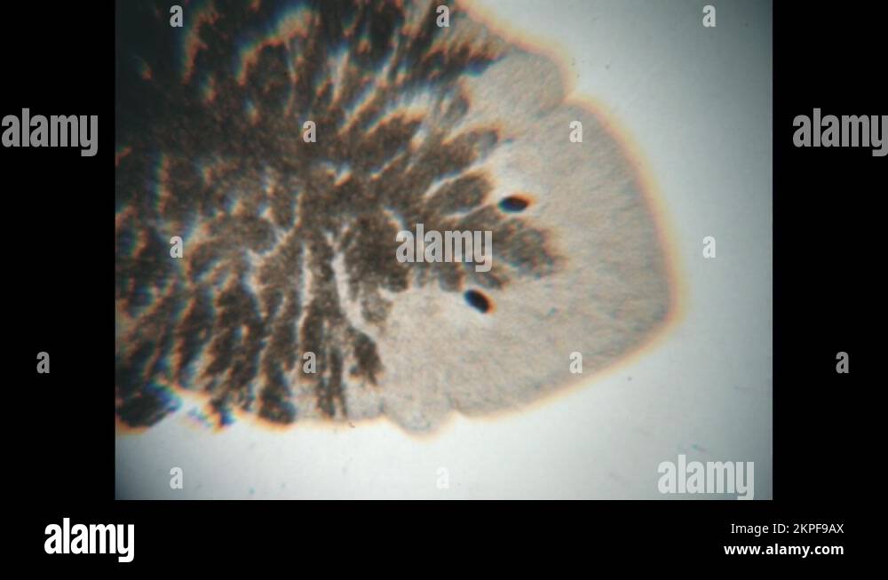 1960s: microscopic view of planarian head. Stained slice through ...