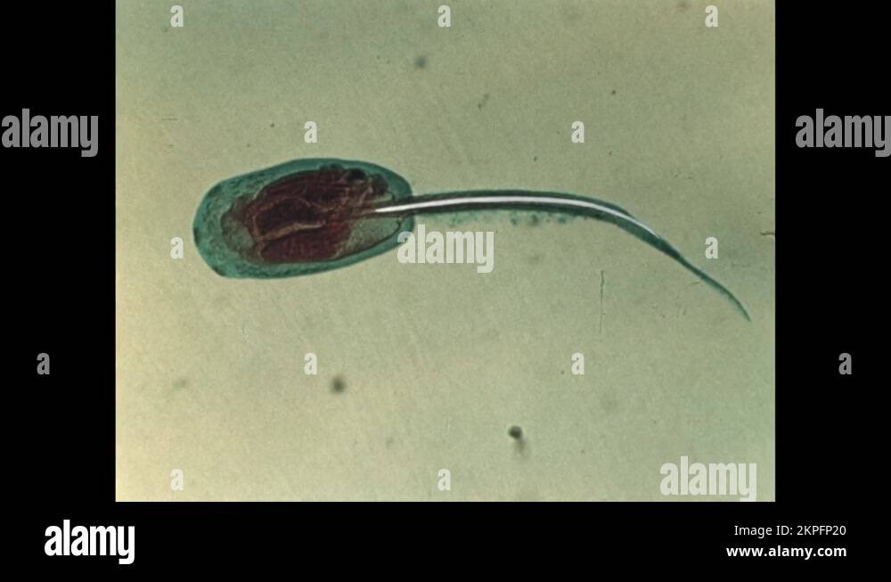 1960s: Lines appear over parts of photograph of amphioxus embryo. Worm ...