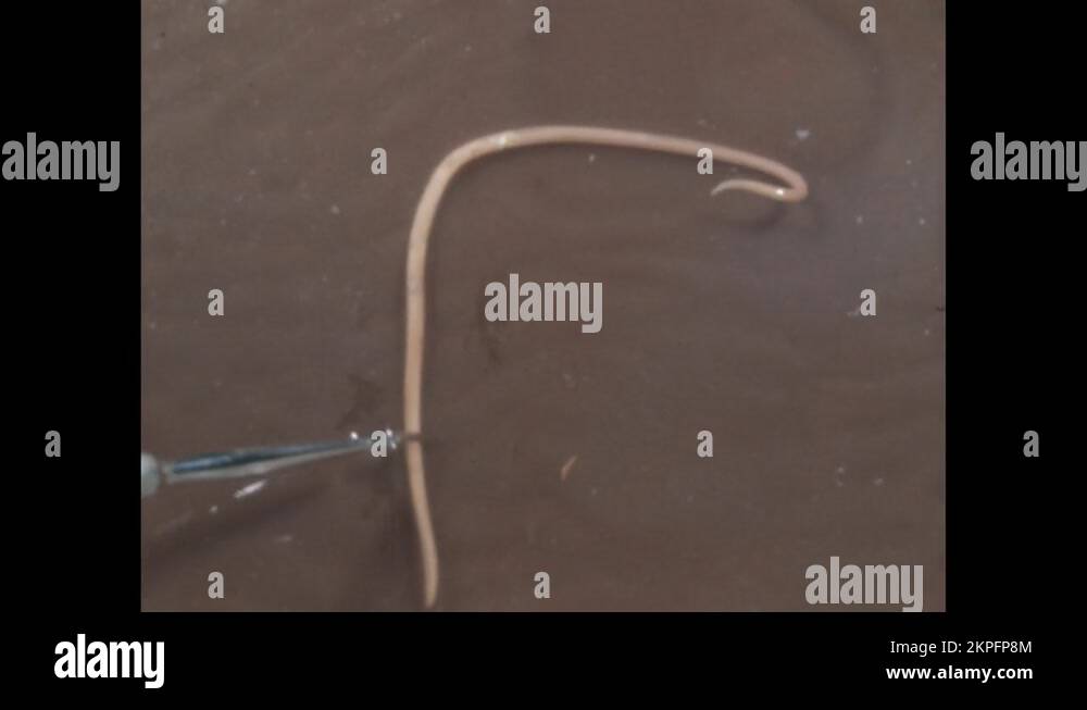 Intestinal worms Stock Videos & Footage - HD and 4K Video Clips - Alamy