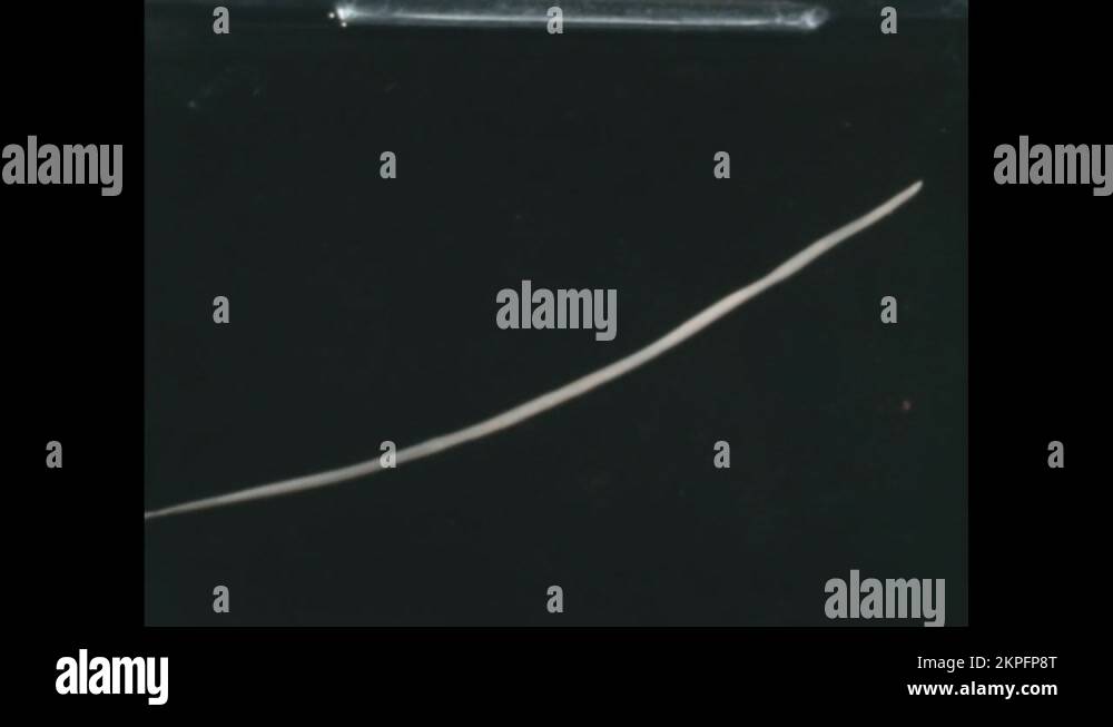 Earthworm cocoon Stock Videos & Footage - HD and 4K Video Clips - Alamy