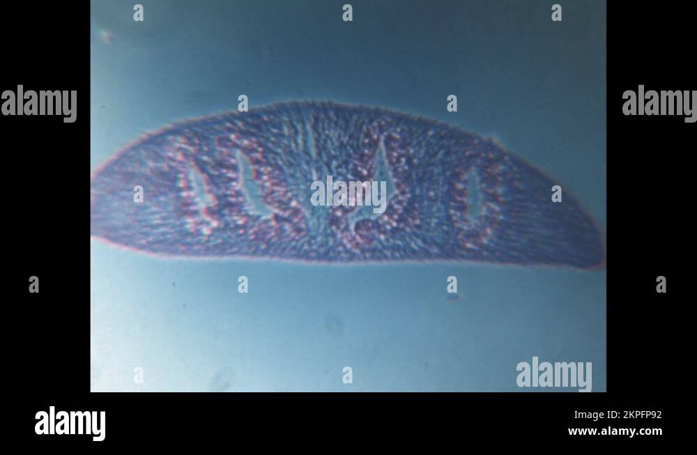 1950s: Stained cross section of worm. Cell death and tissue remodelling ...