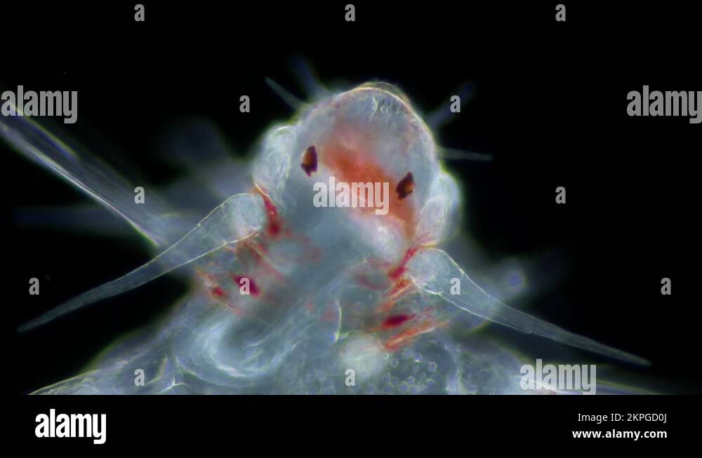 worm Polychaeta under microscope, family Lopadorrhynchidae. Possibly ...
