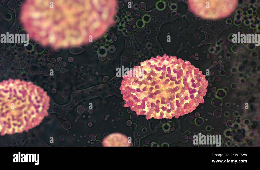 Smallpox viruses Stock Videos & Footage - HD and 4K Video Clips - Alamy