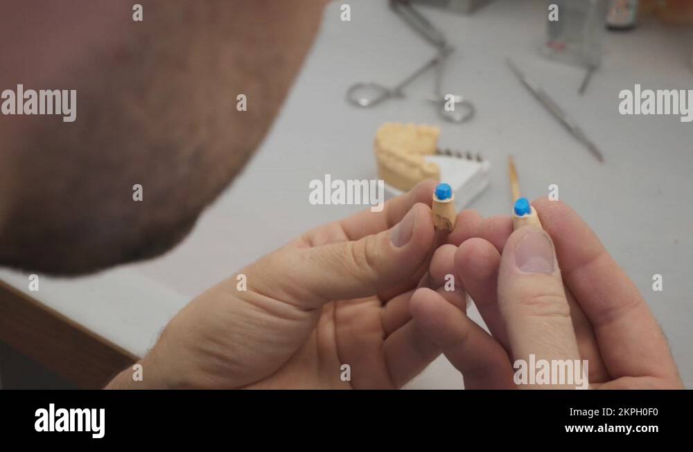 Dental crown fitting Stock Videos & Footage - HD and 4K Video Clips - Alamy