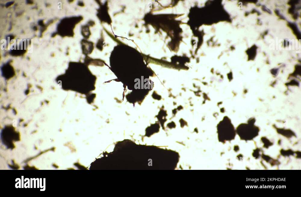 Microscopic tick moves and wiggle paws close-up in laboratory under a ...