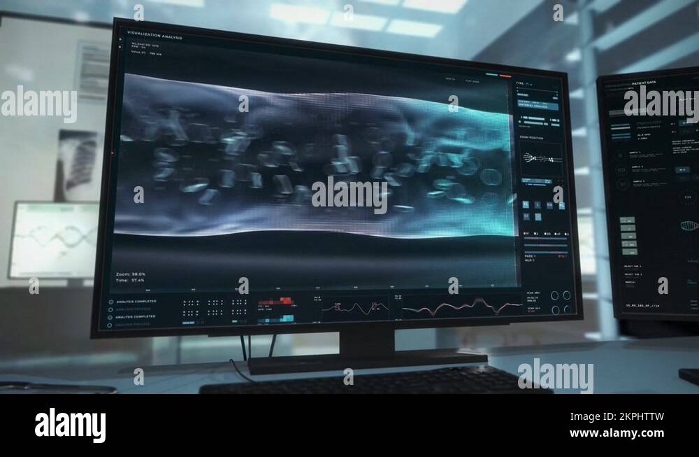 Patients Fourth Blood Type Analyzed By Сomputer Scanner For Medical ...