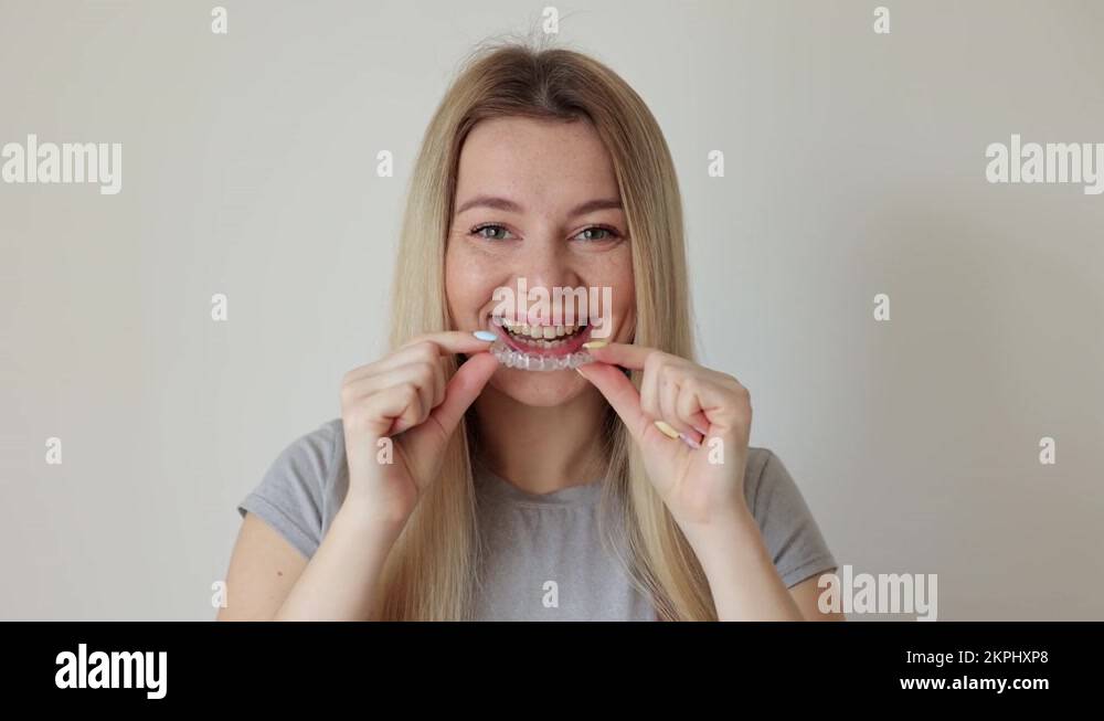 Using teeth braces Stock Videos & Footage - HD and 4K Video Clips - Alamy