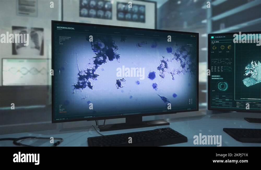 Microbiology Software Interface Conducts Infectious Bacteria Analysis ...