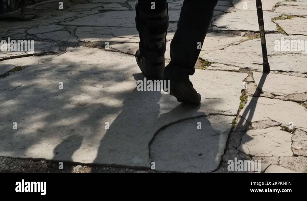 a man with an injured leg moves along a stone road, leaning on one ...