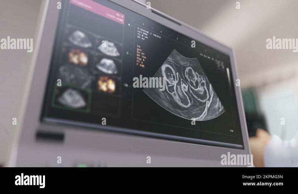 Woman womb Stock Videos & Footage - HD and 4K Video Clips - Alamy