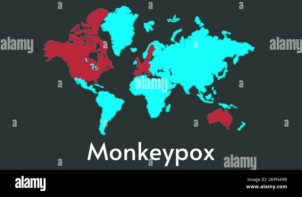 Map of monkeypox infections 2022. Epidemic 2022. Virus 2022 Stock Video ...