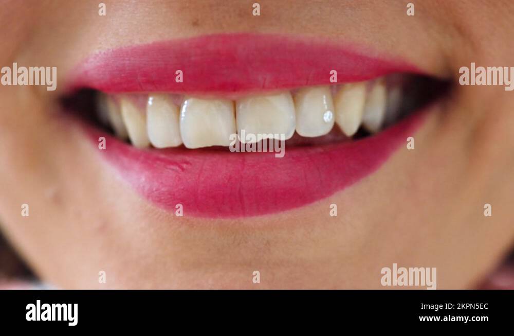 Uneven teeth Stock Videos & Footage - HD and 4K Video Clips - Alamy