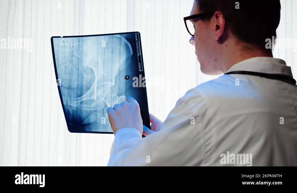 Doctor examining pelvis hip x-ray close-up. Magnetic Resonance Image of ...