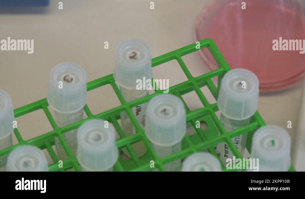 Specimen holder Stock Videos & Footage - HD and 4K Video Clips - Alamy