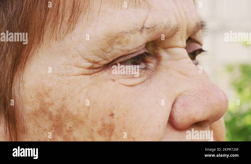Sun spots on skin Stock Videos & Footage - HD and 4K Video Clips - Alamy