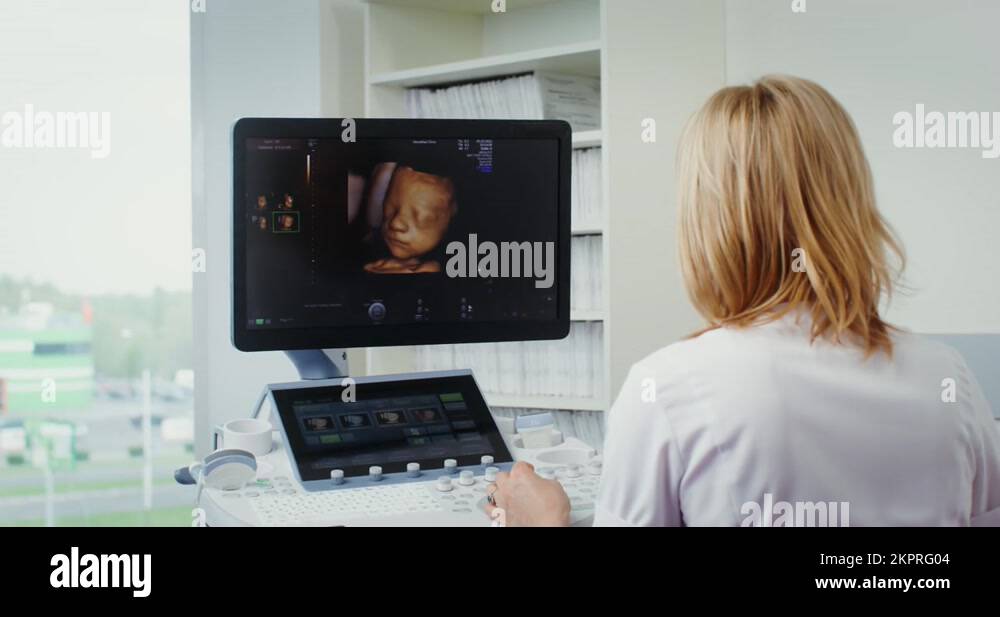 Ultrasound diagnosis of fetal development in a modern clinic Stock ...