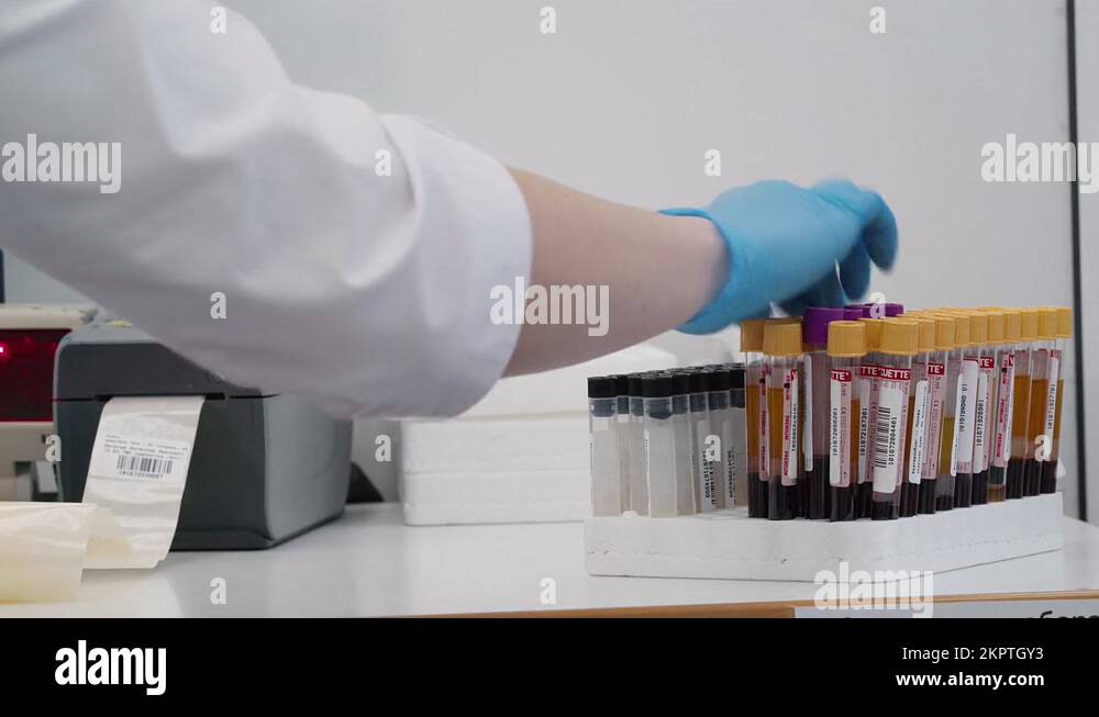 Blood analysis samples Stock Videos & Footage - HD and 4K Video Clips ...