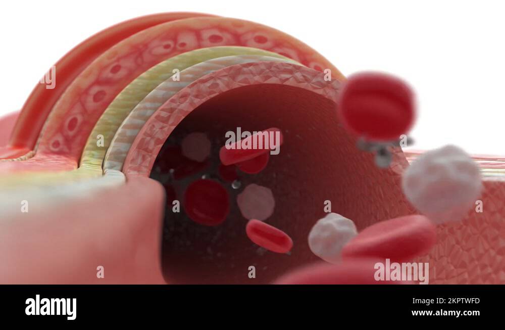 Capillary disease Stock Videos & Footage - HD and 4K Video Clips - Alamy