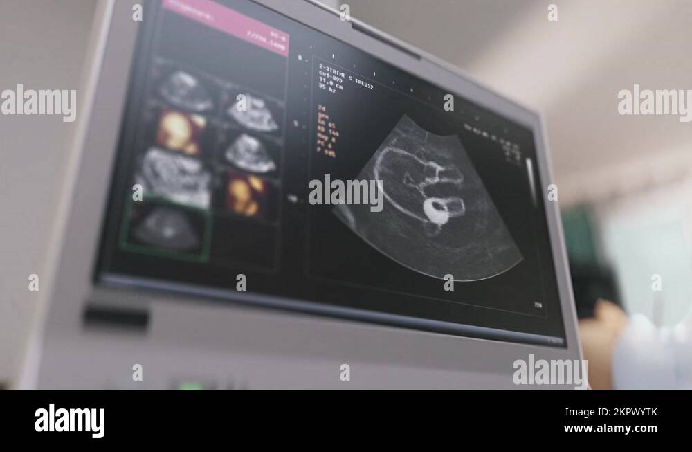 Analysing the condition of the child in the womb at the prenatal clinic ...