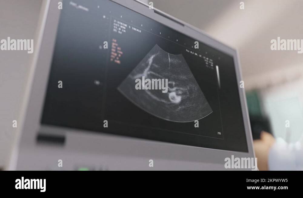 Male reproductive organs Stock Videos & Footage - HD and 4K Video Clips ...