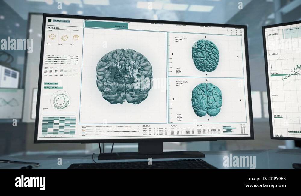 Brain computer interface laboratory Stock Videos & Footage - HD and 4K ...