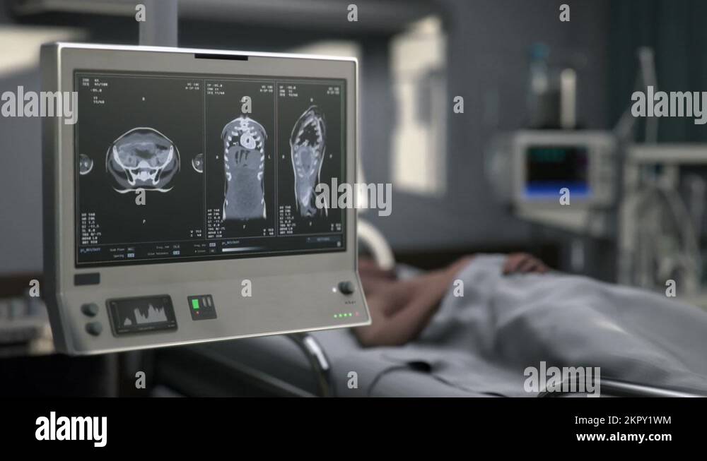 Damaged organs Stock Videos & Footage - HD and 4K Video Clips - Alamy