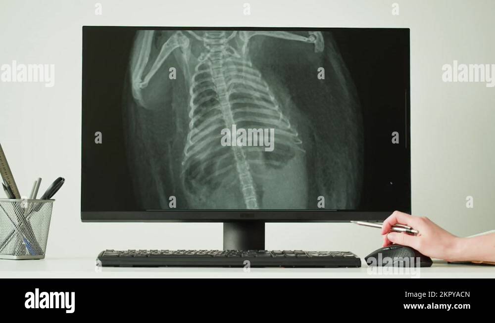 Doctor veterinarian examining hedgehog skeleton roentgen on computer ...
