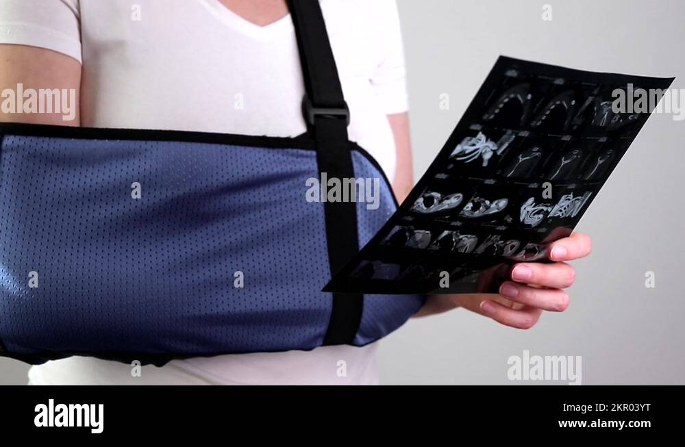 Hand ct scan Stock Videos & Footage - HD and 4K Video Clips - Alamy