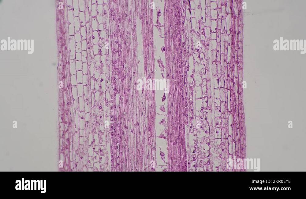 Longitudinal section cut of root tip of plant under the microscope ...