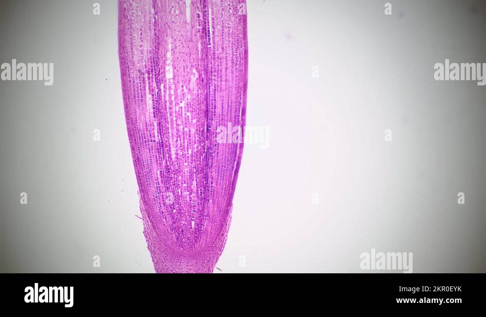 Longitudinal section cut of root tip of plant under the microscope ...