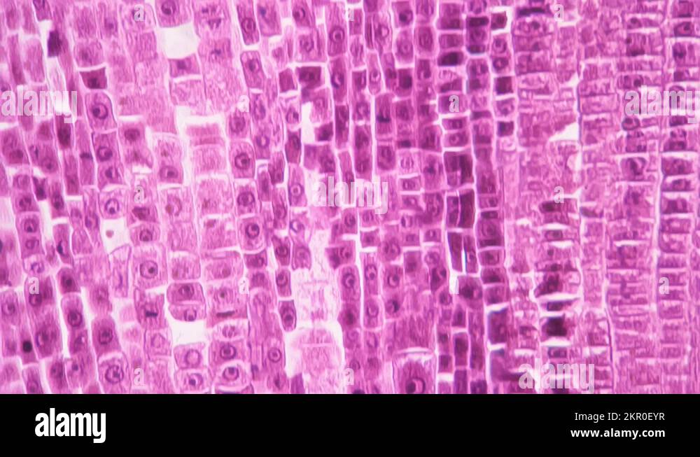 Longitudinal section cut of root tip of plant under the microscope ...