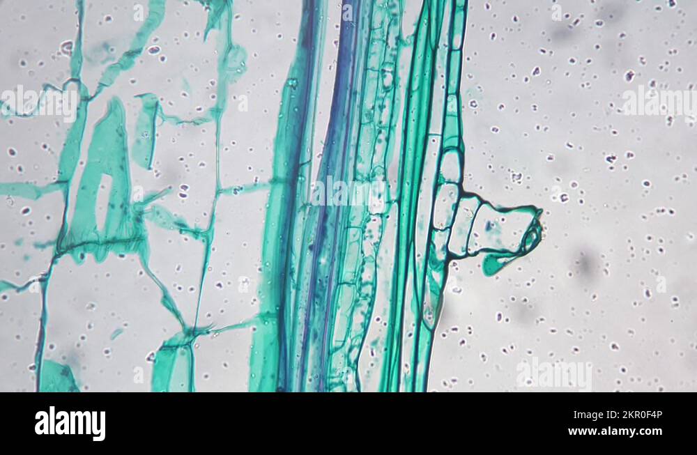 Stem of Cucurbita moschata L.S. under microscope 200x against bright ...