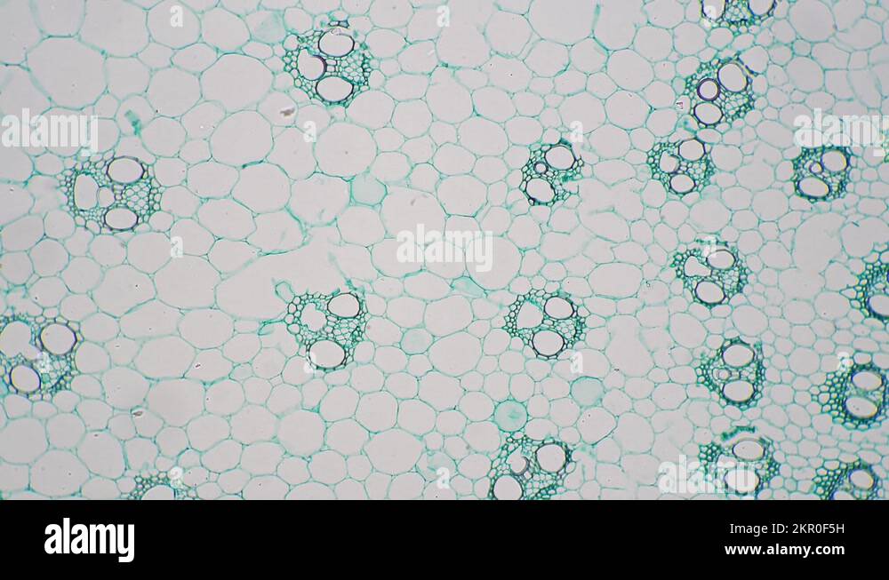 Microscope xylem stem phloem Stock Videos & Footage - HD and 4K Video ...